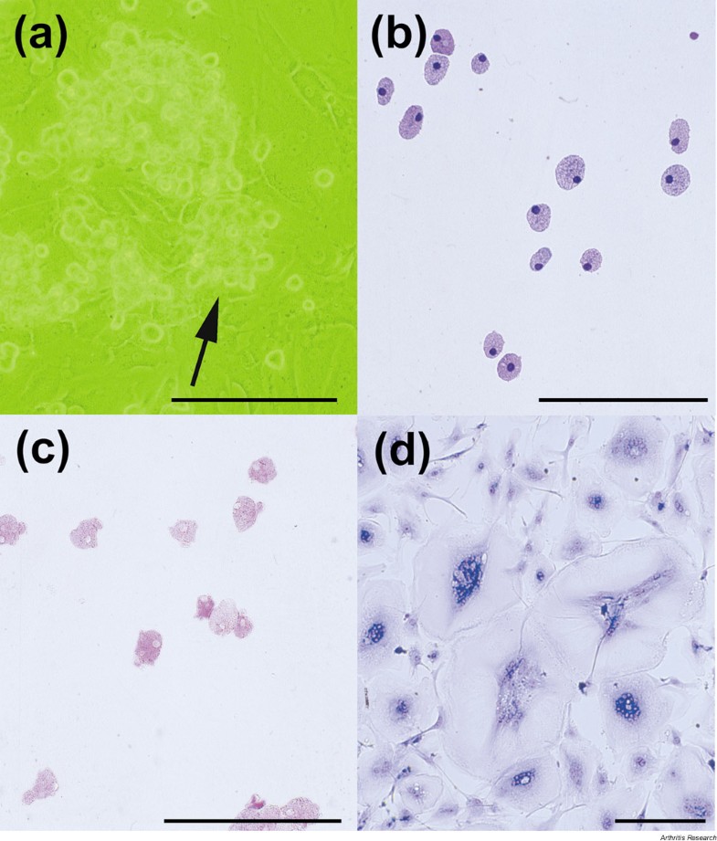 Differentiation of monocytes into multinucleated giant bone-resorbing ...