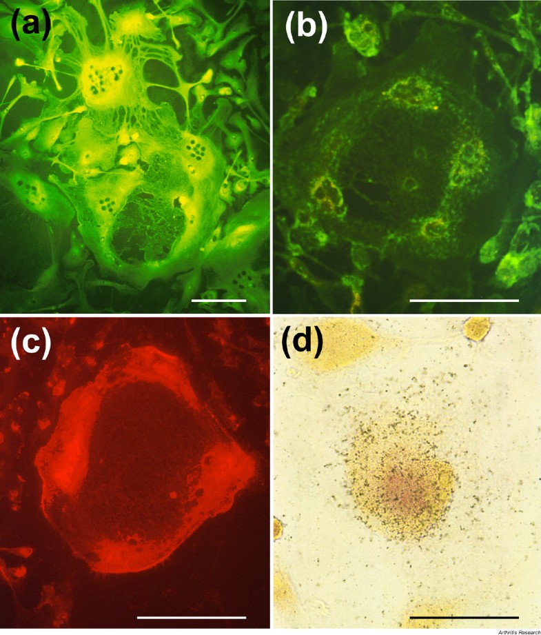 Differentiation of monocytes into multinucleated giant bone-resorbing ...