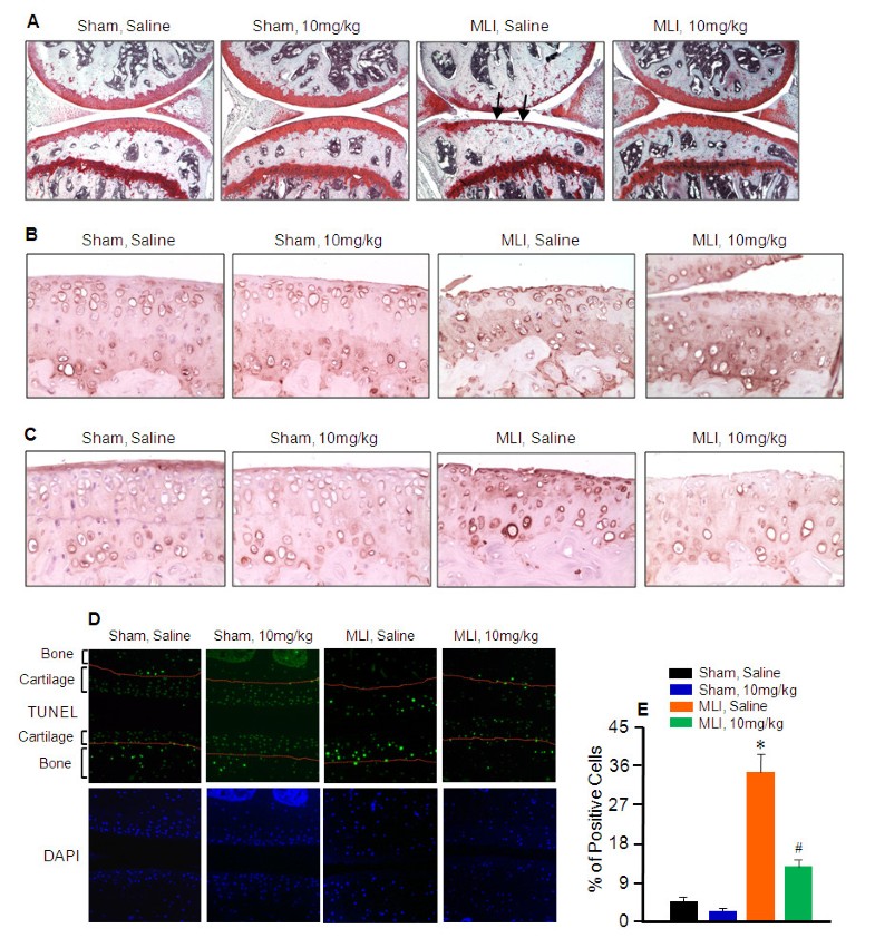 MMP13 is a critical target gene during the progression of ...