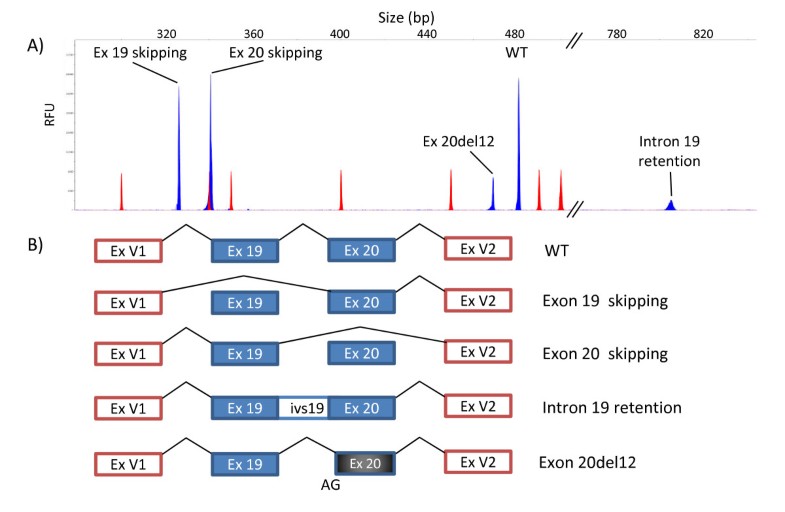 Comprehensive splicing functional analysis of DNA variants of the BRCA2 gene by hybrid minigenes ...