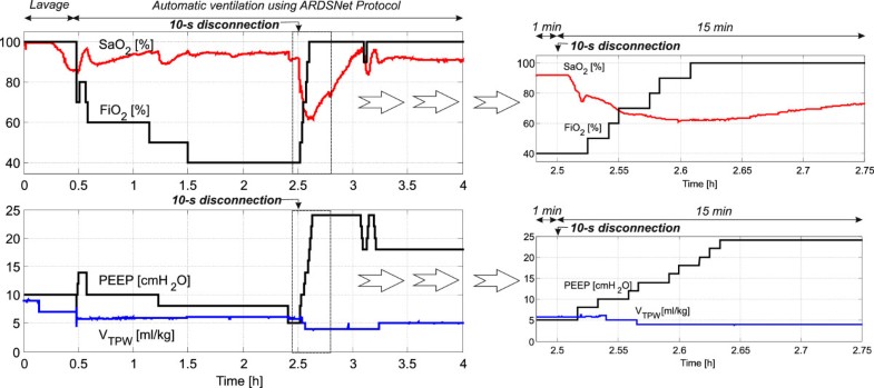 Automatic protective ventilation using the ARDSNet protocol with the ...