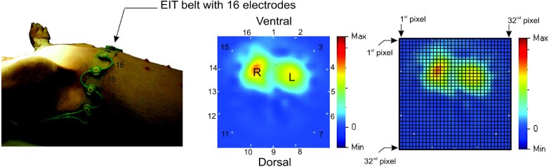Automatic protective ventilation using the ARDSNet protocol with the ...