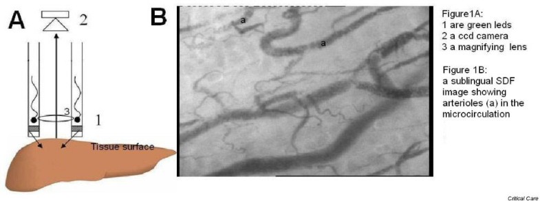 Sidestream dark field imaging: an improved technique to observe ...