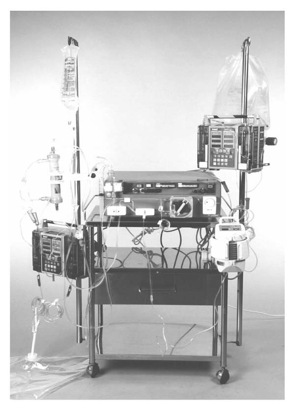 Continuous haemofiltration in the intensive care unit | Critical Care ...