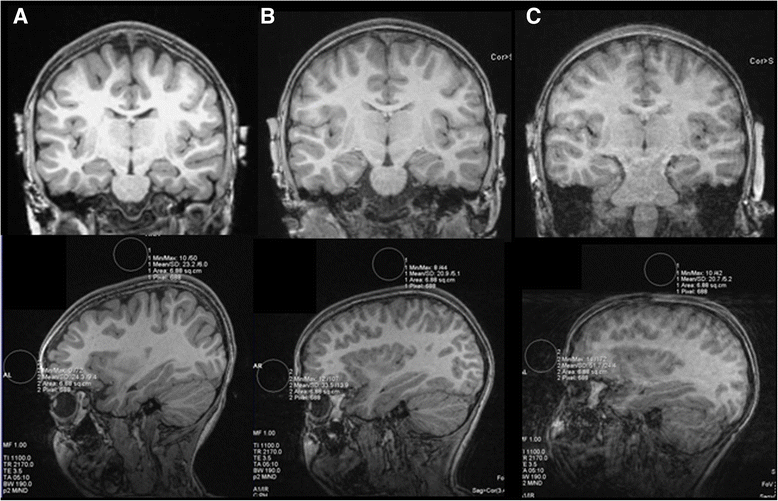 Methods for acquiring MRI data in children with autism spectrum ...