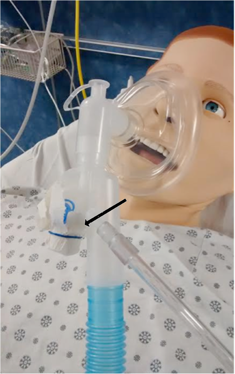 A pilot study of improvised CPAP (iCPAP) via face mask for the ...