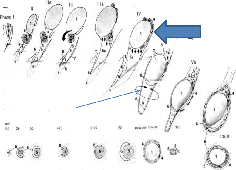 On The Descent Of The Epididymo Testicular Unit Cryptorchidism And