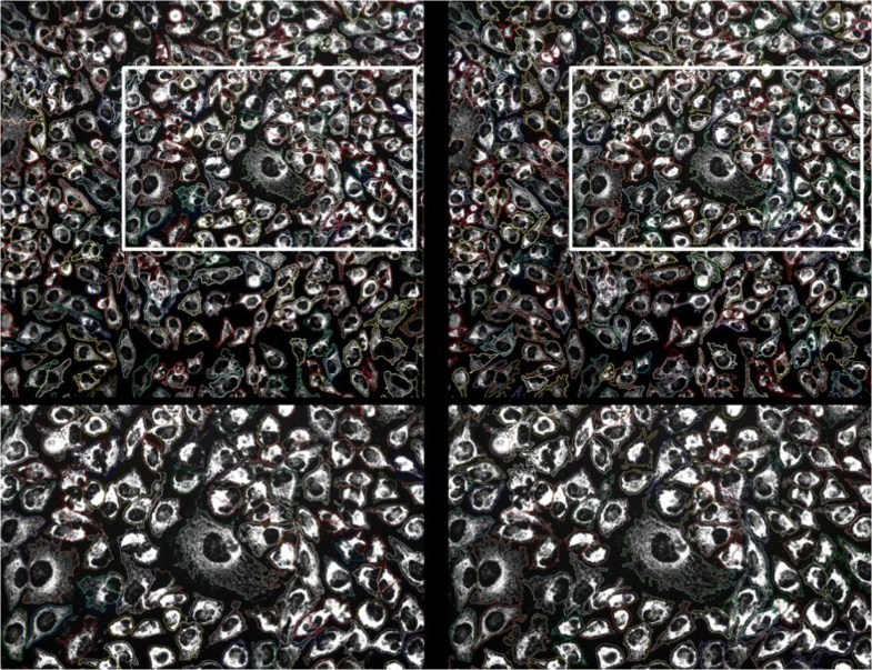 A deep learning-based algorithm for 2-D cell segmentation in microscopy images | BMC ...