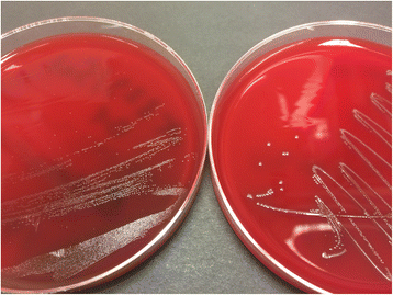 Comparison of pathogenic and non-pathogenic Enterococcus cecorum ...
