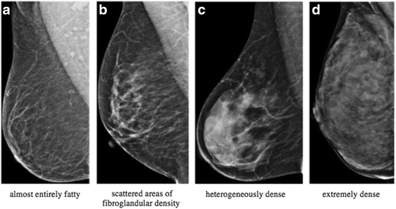 Mammographic density changes in surgical weight loss-an indication for ...