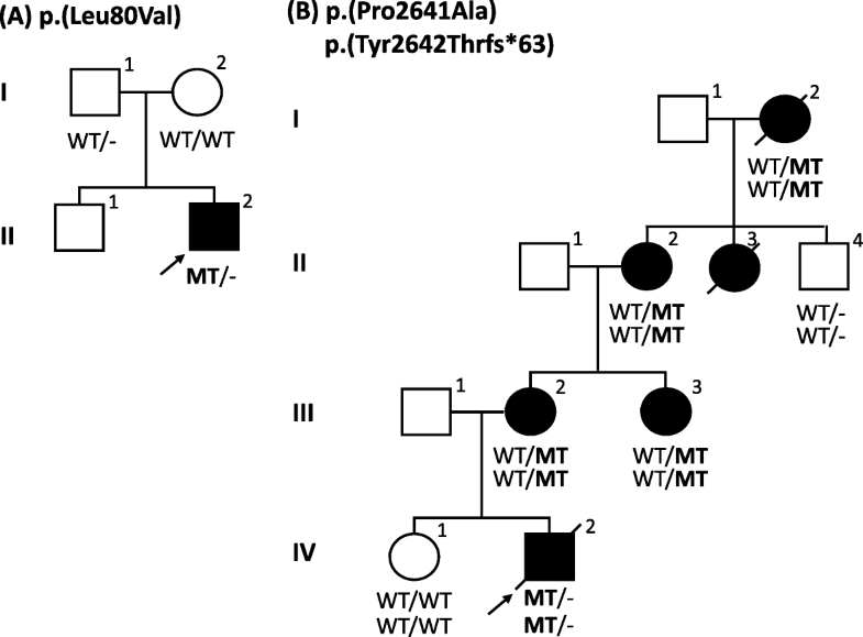 FLNA mutations in surviving males presenting with connective tissue ...