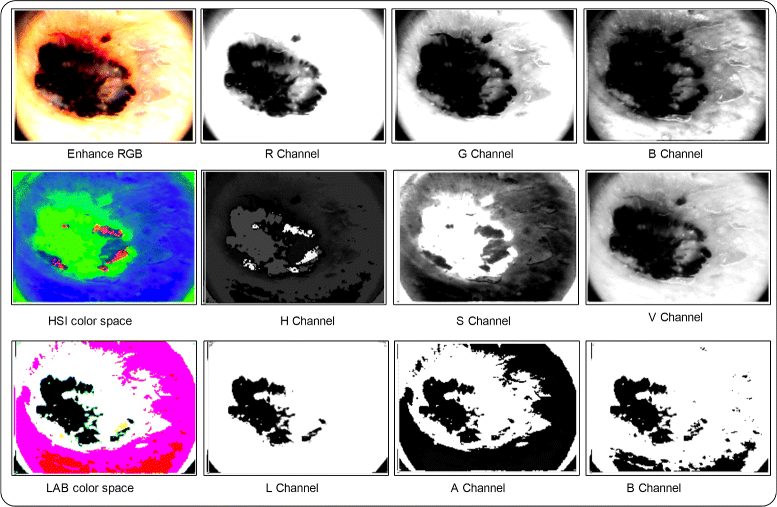 An implementation of normal distribution based segmentation and entropy controlled features ...