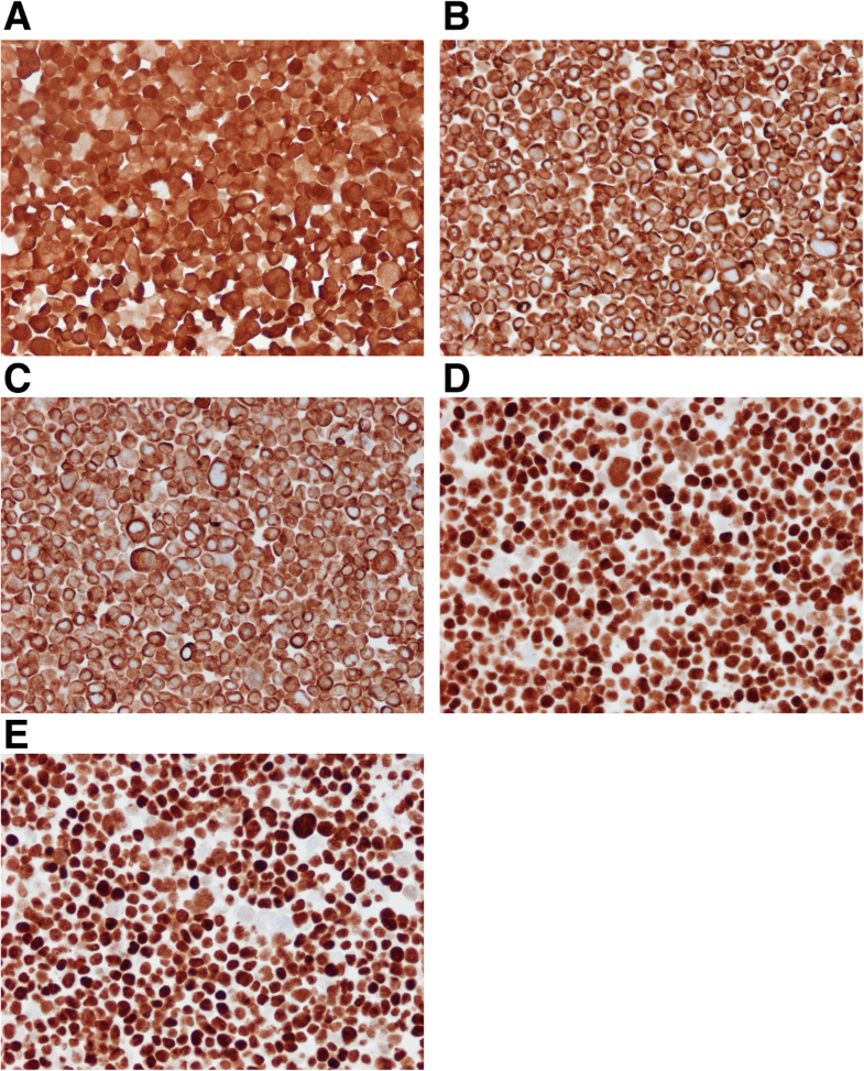 A novel human in vitro papillomavirus type 16 positive tonsil cancer cell line with high ...
