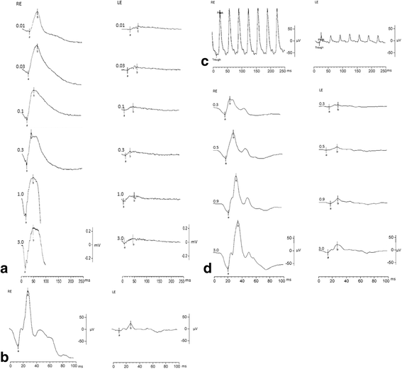 Comparing DTL microfiber and Neuroline skin electrode in the Mini ...