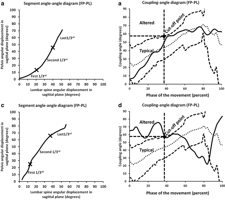 Kinematic characterization of clinically observed aberrant movement ...