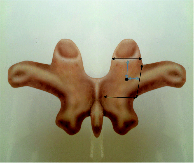 Nutrient foramen location on the laminae provides a landmark for ...