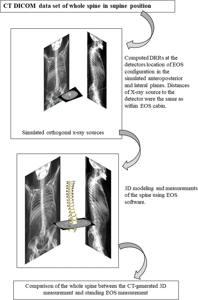 Difference in whole spinal alignment between supine and standing ...