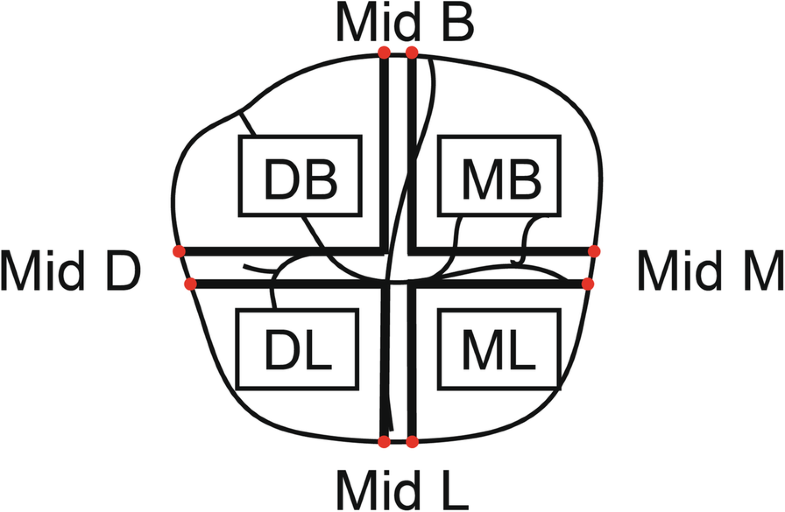An in vitro evaluation of marginal fit zirconia crowns fabricated by a ...