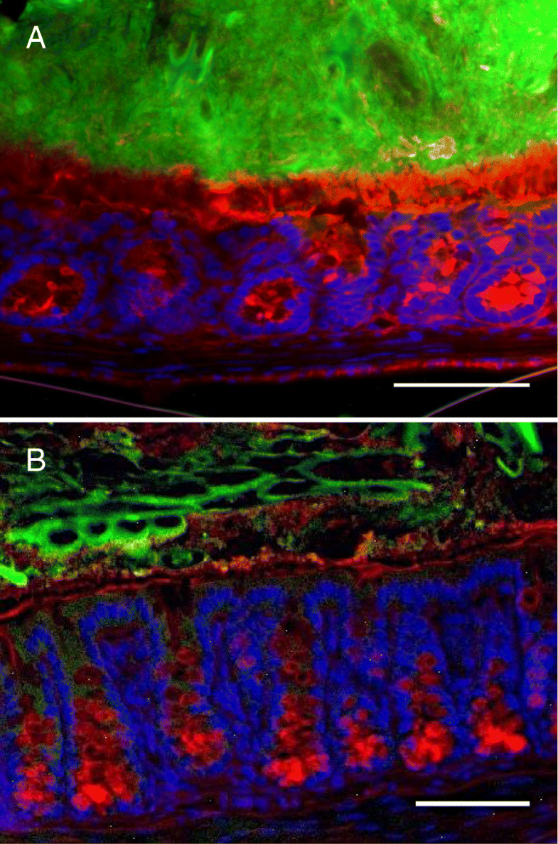 Pathobiont release from dysbiotic gut microbiota biofilms in intestinal ...