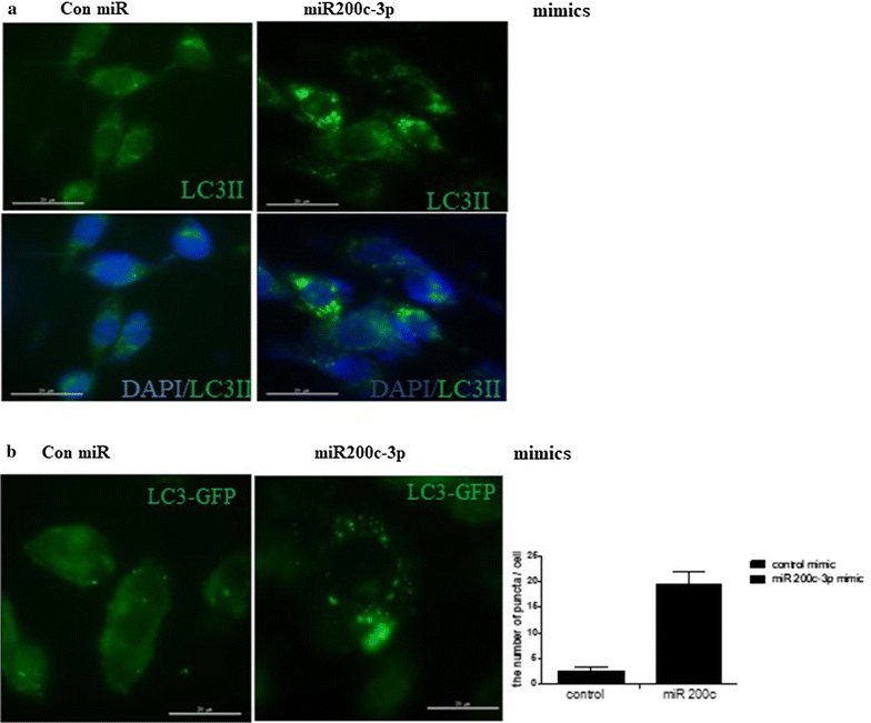 MicroRNA 200c-3p regulates autophagy via upregulation of endoplasmic ...