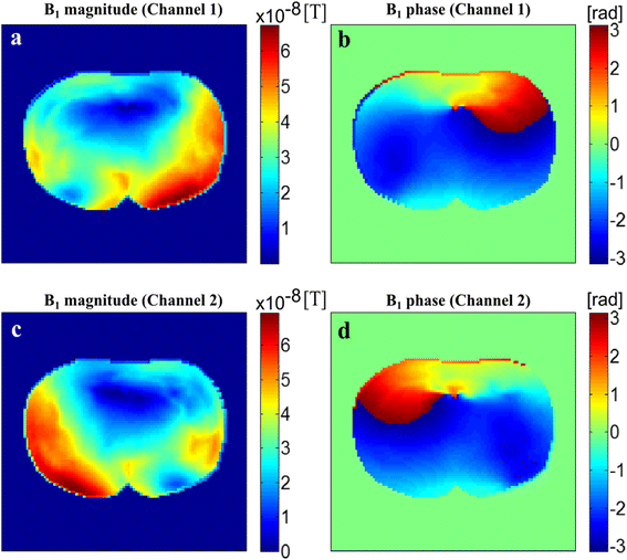Iterative multi-channel radio frequency pulse calibration with ...