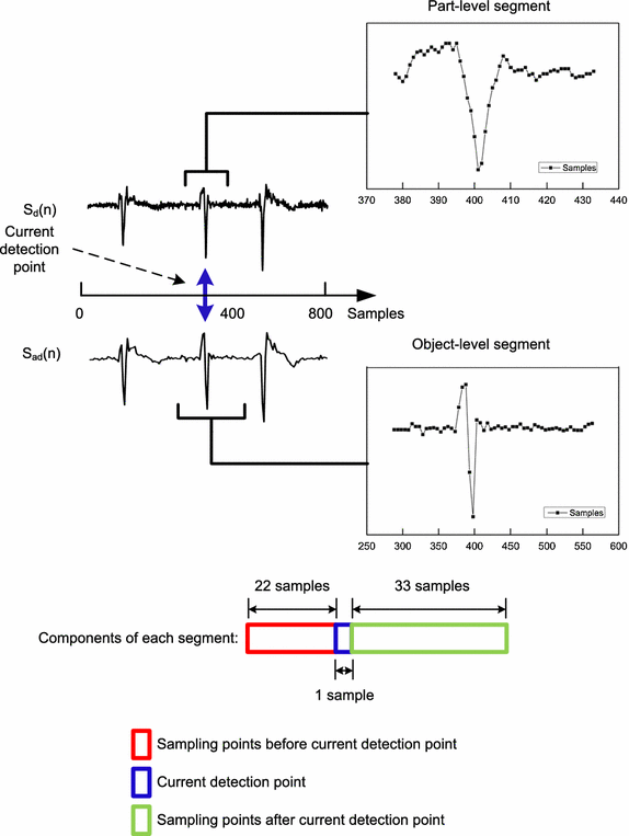 Automatic QRS complex detection using two-level convolutional neural network | BioMedical ...