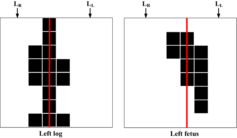 Sleeping posture recognition using fuzzy c-means algorithm | BioMedical Engineering OnLine ...