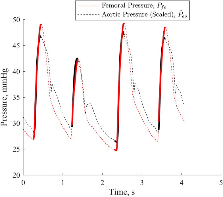 Blood pressure waveform contour analysis for assessing peripheral ...