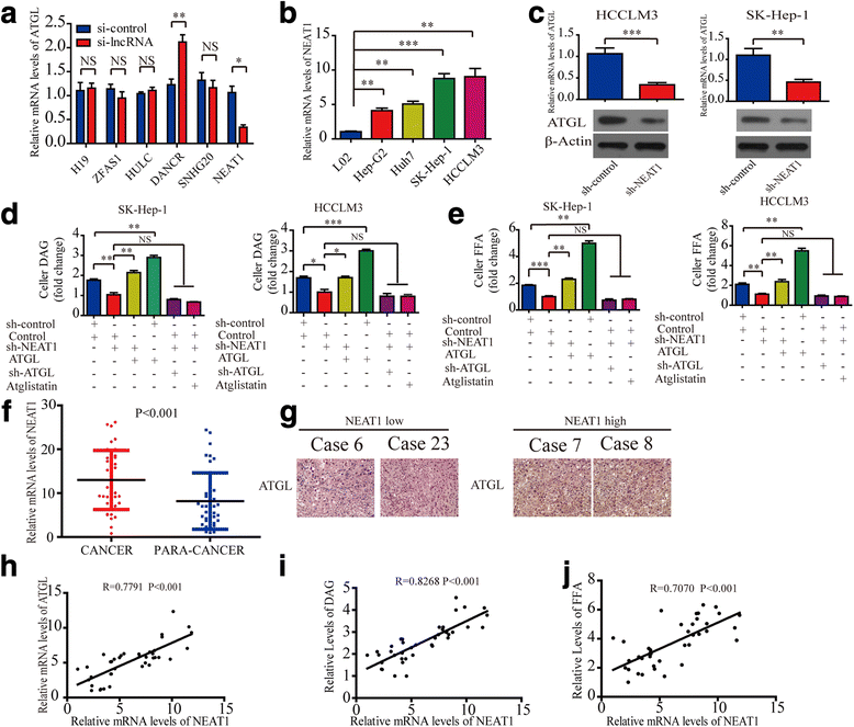 Long non-coding RNA NEAT1-modulated abnormal lipolysis via ATGL drives ...