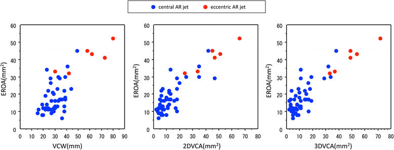 Severity of aortic regurgitation assessed by area of vena contracta: a ...