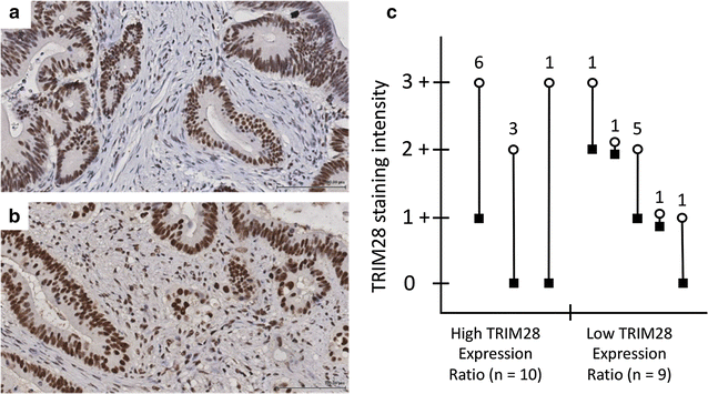 Stromal TRIM28-associated signaling pathway modulation within the ...