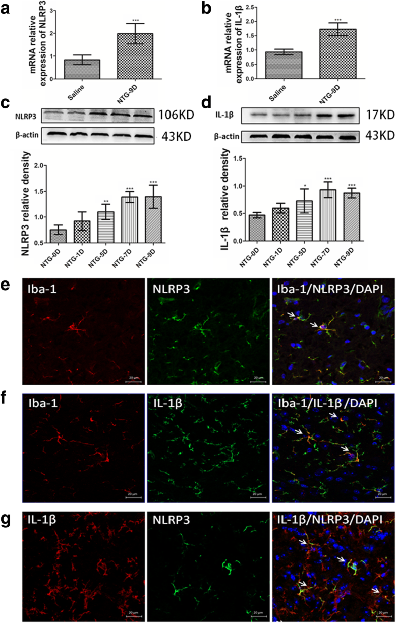 Microglial NLRP3 inflammasome activation mediates IL-1β release and ...