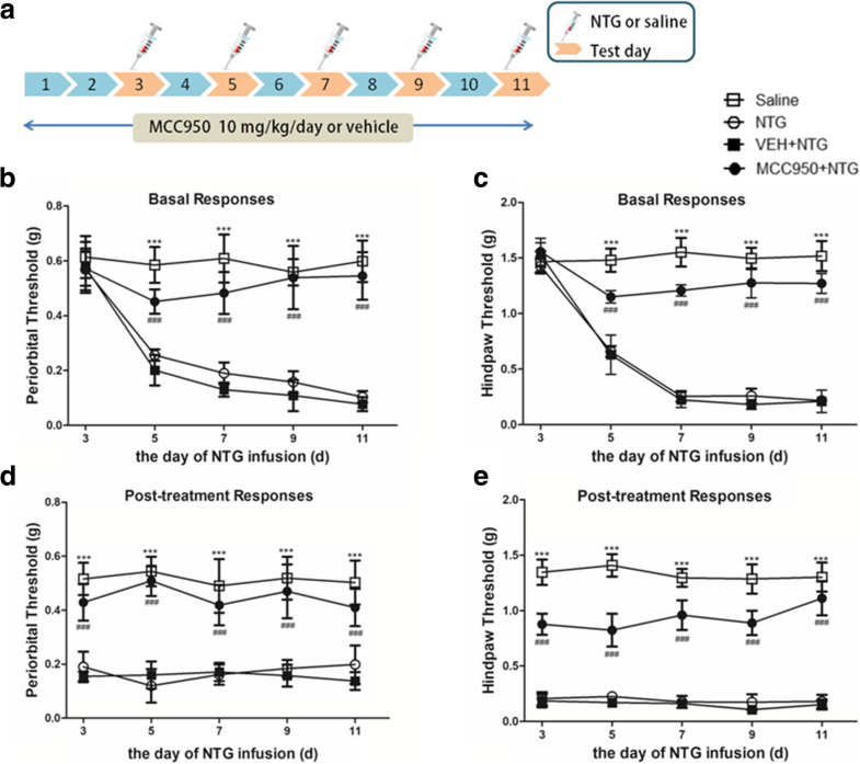 Microglial NLRP3 inflammasome activation mediates IL-1β release and ...