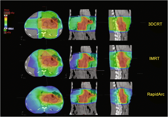 Double-arc volumetric modulated therapy improves dose distribution ...