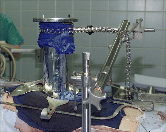 Intraoperative radiation therapy (IORT) in pancreatic cancer ...