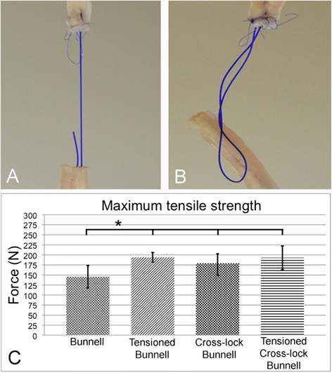 Bunnell or cross-lock Bunnell suture for tendon repair? Defining the ...
