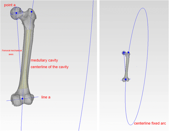 Analysis of factors that affect the precision of the radiographic ...