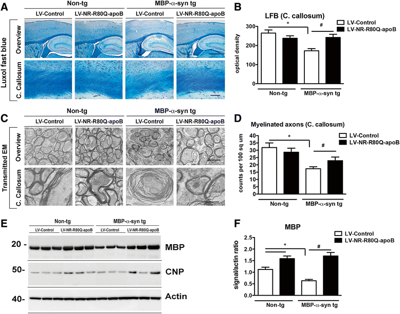 A brain-targeted, modified neurosin (kallikrein-6) reduces α-synuclein ...