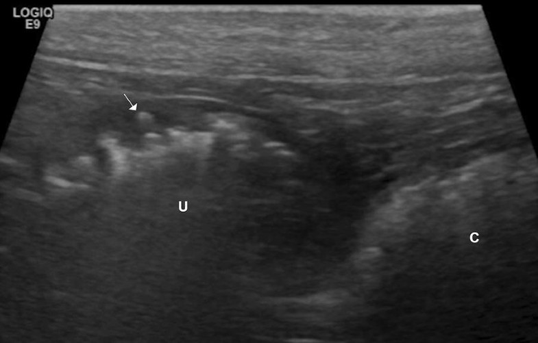 Radiographic and ultrasonographic findings in a dog with emphysematous ...