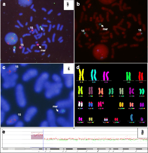 Identification of small marker chromosomes using microarray comparative ...