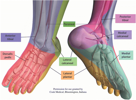 The comparative efficacy of angiosome-directed and indirect ...
