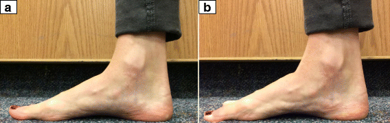 Reliability of doming and toe flexion testing to quantify foot muscle ...