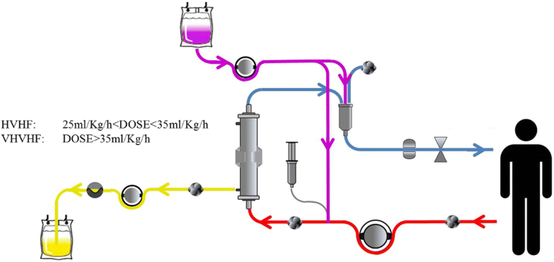 Extracorporeal techniques for the treatment of critically ill patients ...
