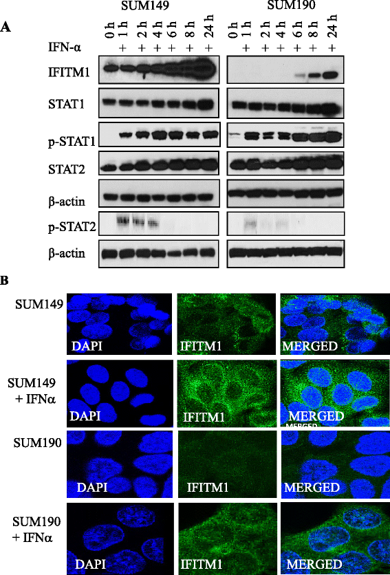 Interferon-induced transmembrane protein 1 (IFITM1) overexpression ...