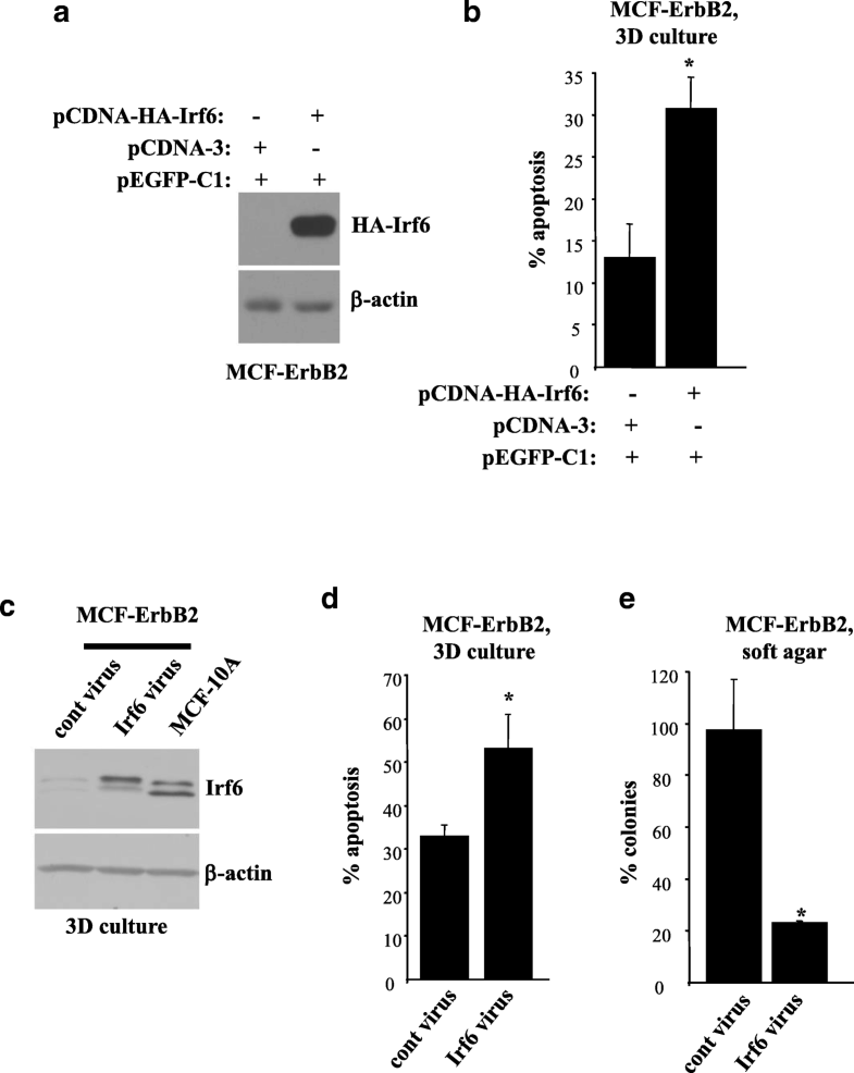 ErbB2-driven downregulation of the transcription factor Irf6 in breast ...