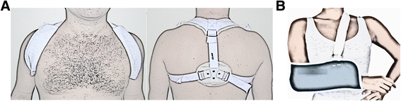 Figure-of-eight bandage versus arm sling for treating middle-third ...