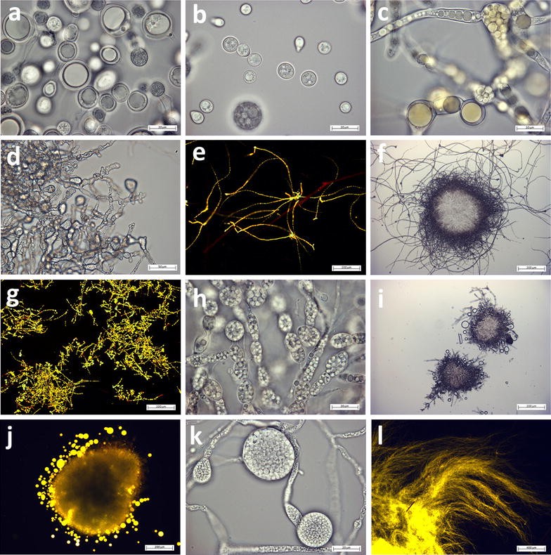 High-throughput screening of Mucoromycota fungi for production of low ...
