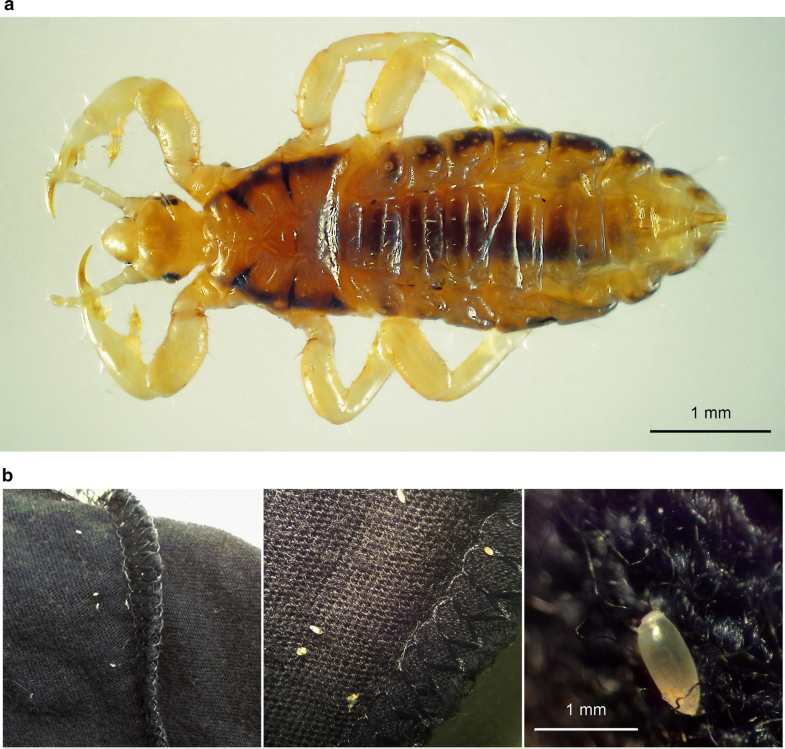 Report of the human body louse (Pediculus humanus) from clothes sold in ...