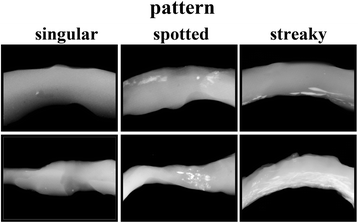 Calcification of the acetabular labrum of the hip: prevalence in the ...