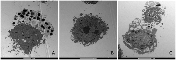 Escherichia coli from Crohn’s disease patient displays virulence ...